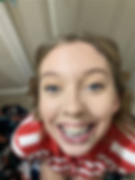 Daddy Came All Over My Braces 😁 ️ Rcumsluts