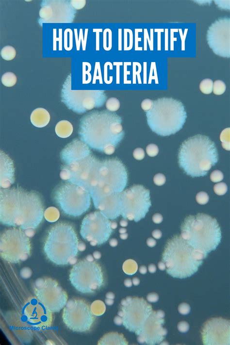 Identification Of Bacteria Is Always Evolving There Are Tons Of