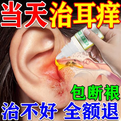 利君康耳朵痒止痒抑菌消炎药治疗中耳炎耳道发炎流脓水真菌感染的滴耳液 单盒装【快速止痒】 耳道瘙痒【图片 价格 品牌 报价】 京东