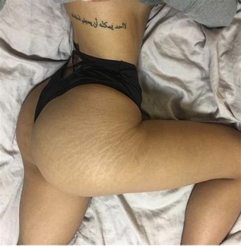 Stretchmarks Can Be Beautiful Too Porn Pic Eporner