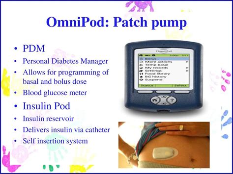 Diabetes The Basics Sue Bettenhausen Apn Cde Bc Adm Clinical Nurse Specialist West Suburban