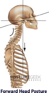 Forward Head Posture What Is It How Can It Affect You
