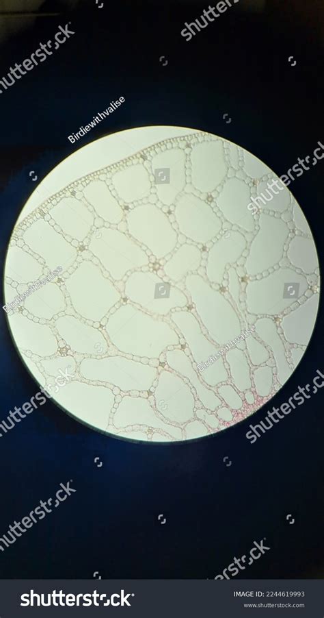 Aerenchyma