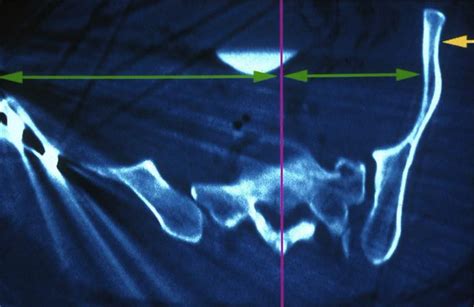 Need To Know Criteria And Classification Systems Ortho Conditioning