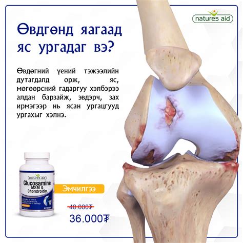 Өвдгөнд яс ургасан үед илрэх Natures Aid Mongolia