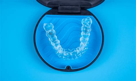 Understanding The Difference Between Braces And Invisalign