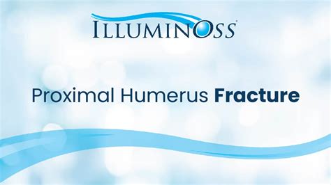 Case Illustration Proximal Humerus Fracture