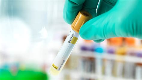 中国核药，撕开了一个口