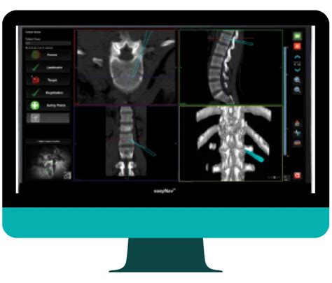 Spine Navigation System At Best Price In Thrippunithura By Medbionix
