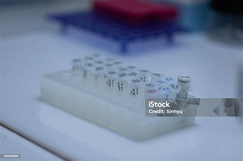 중합효소 연쇄 반응 및 아가로즈 젤 전기 동아나는 실험실에서 생화학 분자 생물학 유전학 및 임상 화학에 사용되는 젤 전기 동거의