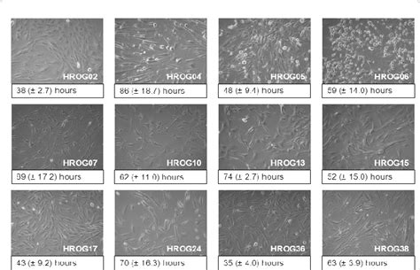 Cell Line Morphology And Doubling Times Depicted In This Figure Are