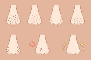 Everything You Need To Know About Bumps On The Nose Health Report