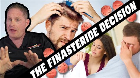 Hair Vs Sex More The Finasteride Decision Dr O Helps You Understand Whats Right For You