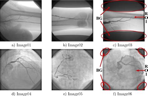 figure 1 1 from diagnostically lossless compression strategies for x
