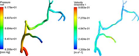Cfd Simulation Results Pressure Distribution On The Arterial Wall And