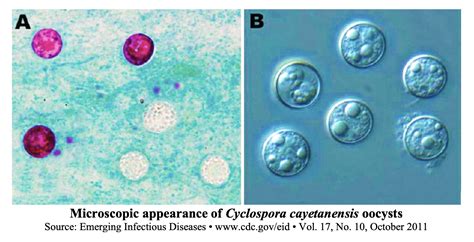 What Is Cyclospora Cayetanensis Cyclospora Blog