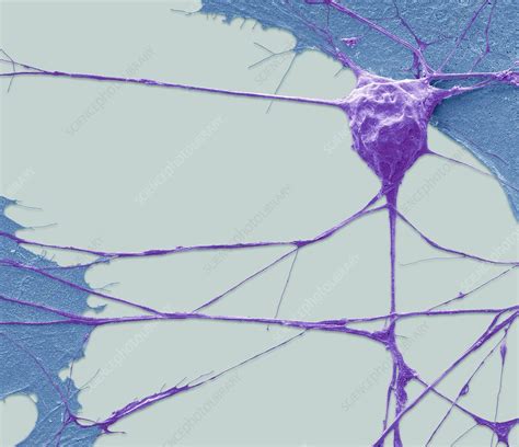 Stem Cell Derived Motor Neuron Sem Stock Image F0225758 Science