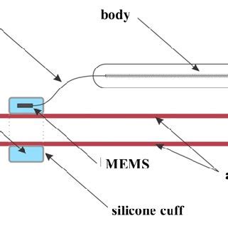 MEMS Device Design Option Download Scientific Diagram