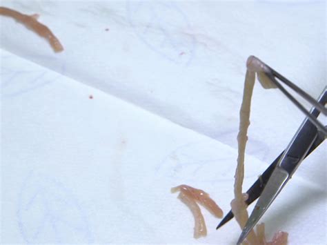 Video Analysis Of Cell Suspensions Isolated From Solid Tissues By