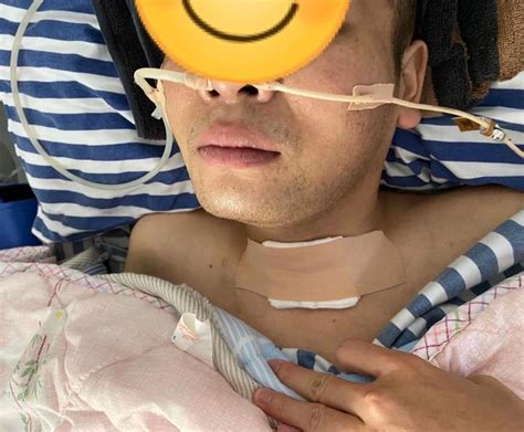 5例气管切开患者拔除套管的病例分享 知乎