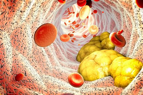 Find A Montefiore Einstein Media Expert Medical Specialists