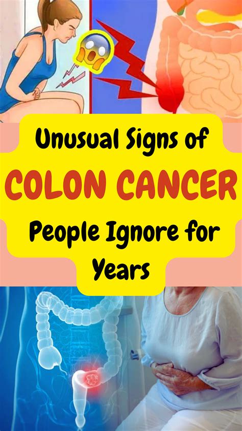 Migmedya Com Unusual Signs Of Colon Cancer That A Lot Of People