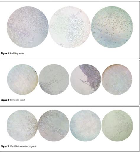 General Characteristics Of Yeast Biology Ease