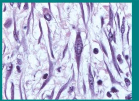 Connective Tissue Flashcards Quizlet