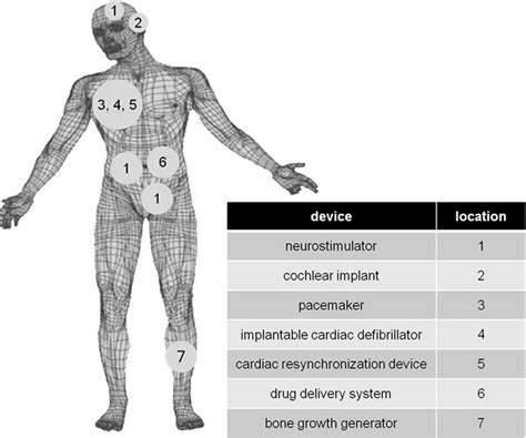 Implanted Biomedical Devices Download Scientific Diagram