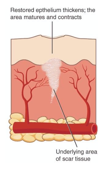 Tissue Healing Understanding The 4 Phases For Optimal Recovery Pt Evolve