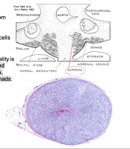 Pathology Of The Adrenal Cortex Flashcards Quizlet