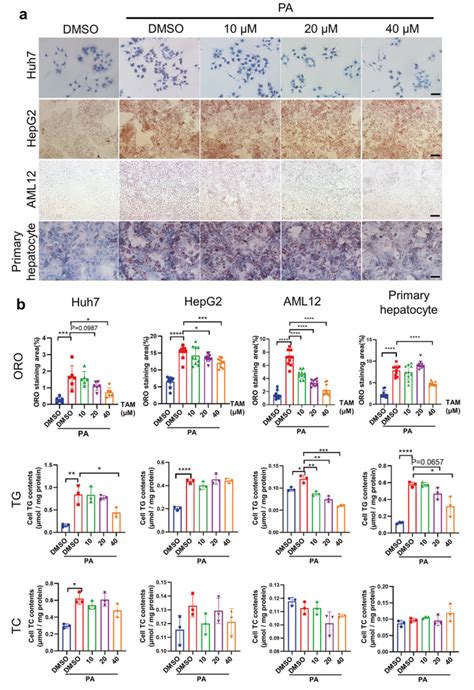 使用棕榈酸钠bsa完成原代肝细胞、两种人肝细胞系huh7和hepg2以及小鼠肝细胞系aml12的肝细胞脂肪毒性研究（他莫昔芬给药改善小鼠肝脂肪变性if 39 3） 知乎