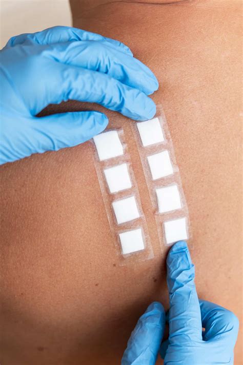Patch Test A Roma Visita Allergologica