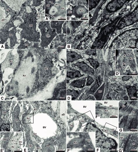 Innervation In The Odontoblast Layer Of Cell Re Associations Implanted Download Scientific