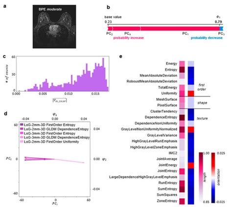 Explainable Precision Medicine In Breast Mri A Combined Radiomics And