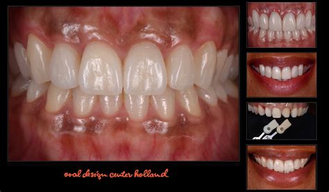 Eric Van Der Winden Oraldesign Hollywood2017 ページ！