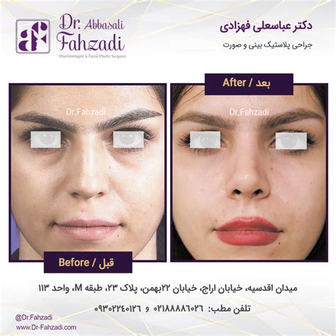 دکتر عباسعلی فهزادی متخصص گوش، گلو و بینی و جراحی سر و گردن تهران