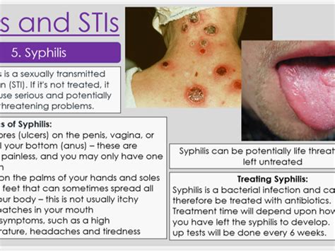 sexually transmitted diseases infections std sti teaching resources