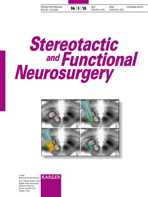 Diode Directional Orientation Detection Of Segmented Deep Brain