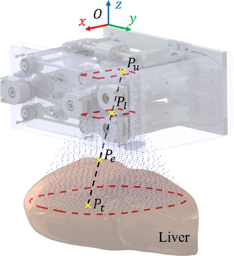 Figure 1 From Body Mounted Mr Conditional Robot For Minimally Invasive Liver Intervention