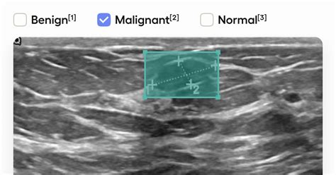 Quickly Create Datasets For Training Yolo Object Detection With Label