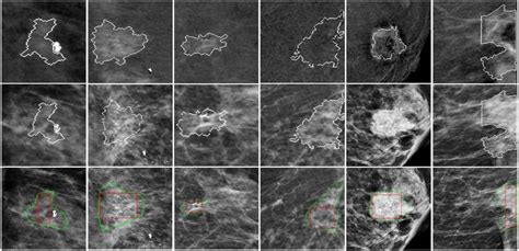 Sample Cases Illustrating Segmentation With Optimal Mapping On Both Download Scientific
