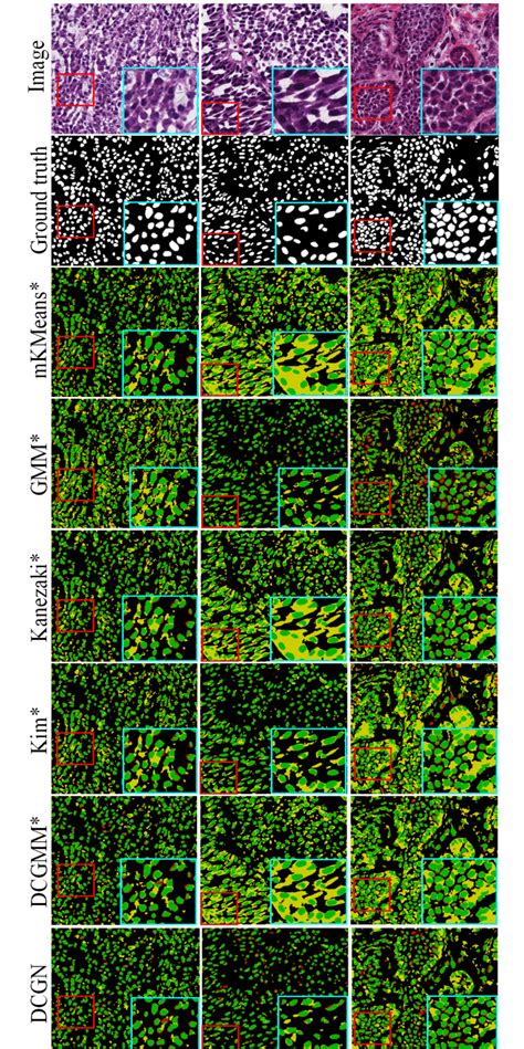Comparison Of Unsupervised Cell Segmentation Results Where Denotes
