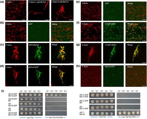 Biochemical Analysis Of Motwf Af Microscopy Imaging Of F‐actin In