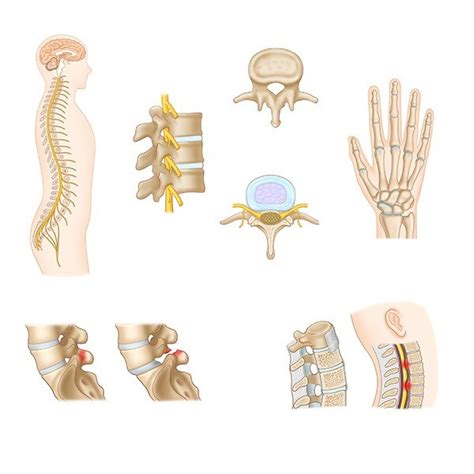 한의원 홈페이지 개편 일러스트디스크척추 일러스트 포트폴리오 크몽