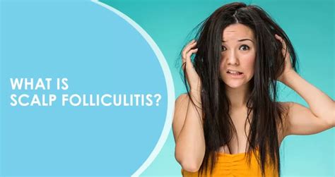 Dermatologist For Scalp Folliculitis Symptoms Treatment Szsg