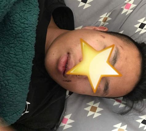 Asian Man Brutally Beaten At Oc Night Market After Refusing To Let A White Man Cut In Line