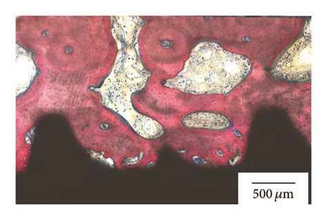 Representative Histologic Sections Of The Boneimplant Interface For