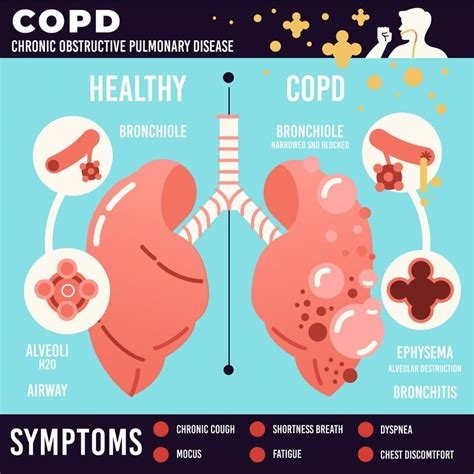 Understanding Copd Abacus Training Centre Ltd