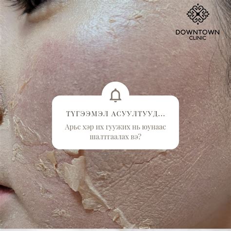 Downtown Clinic Greenpeel 🍀🍀🍀Арьс хэр их гуужих нь юунаас шалтгаалах вэ гэсэн